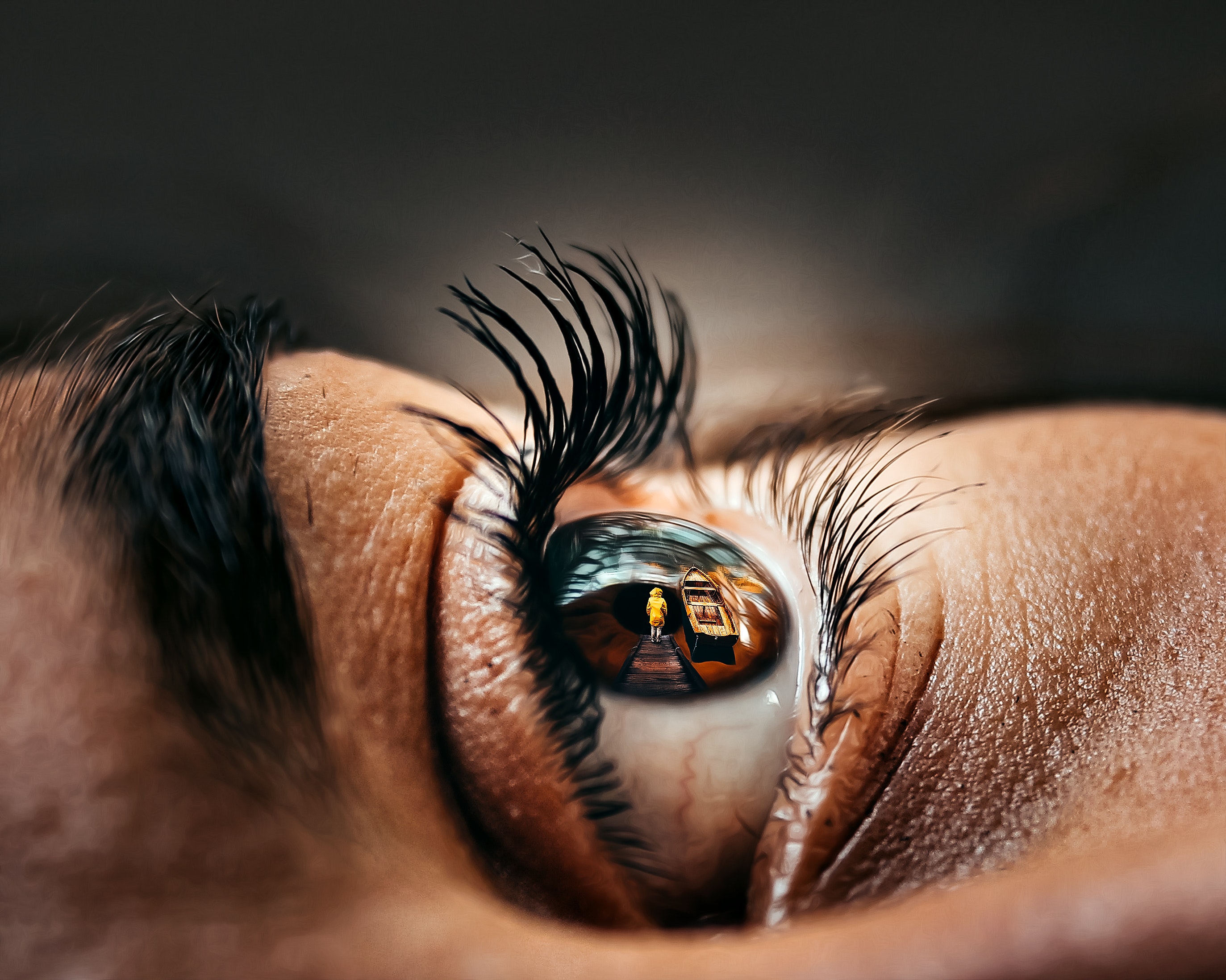 Eyelid Growths Phoenix | Arizona Eye Specialists | Aesthetics - Arizona ...